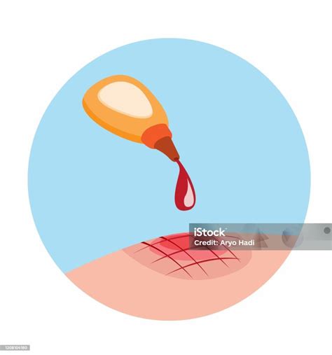 베타딘 에 흉터 요오딘 포비동 액체 에 안티 패혈증 스크래치 피부 기호 만화 플랫 일러스트 벡터 Eps 10 상처에 대한 스톡