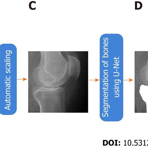 Flowchart Of The Proposed Method A Input Radiograph B Bones