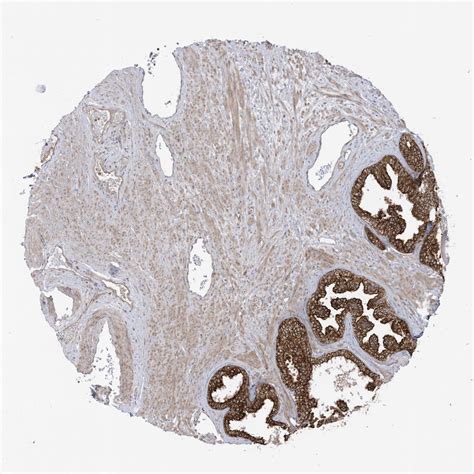 Tissue Expression Of Cgas Staining In Prostate The Human Protein Atlas