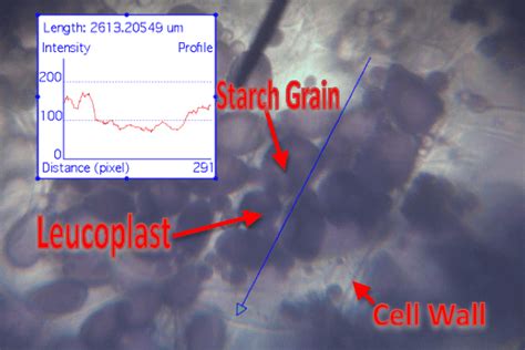Potato Cell Leucoplast