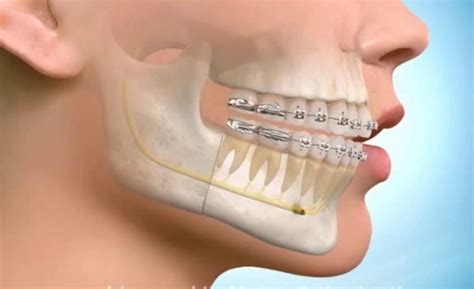 ORTODONTİ horasandental