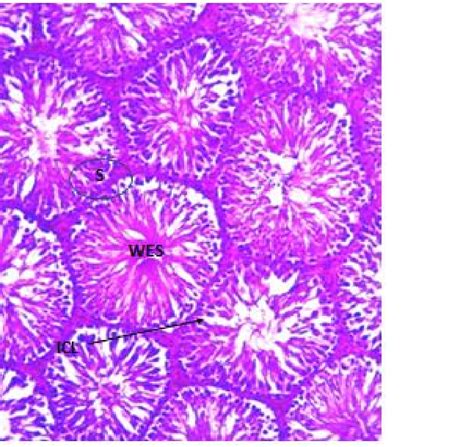 Photomicrograph Sections Of The Testes In Group A Showed Normal Download Scientific Diagram