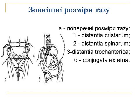 Жіночий таз Плід як обєкт родів Акушерська термінологія