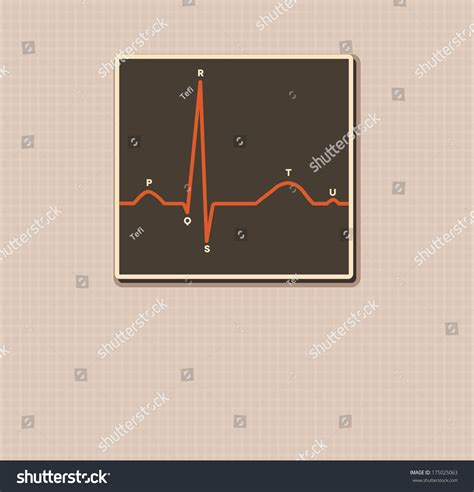Human Heart Normal Sinus Rhythm Electrocardiogram Stock Vector Royalty