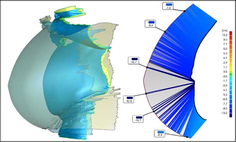 Comparison Of Structured Light Data Comparing 36 Weeks To Post Partum