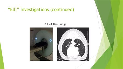 Osteosarcoma Presentation Pptx