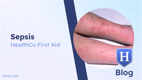Healthco First Aid Sepsis Healthco