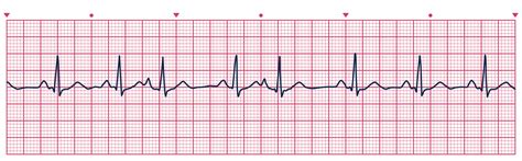 Unc Media Heart Rhythms
