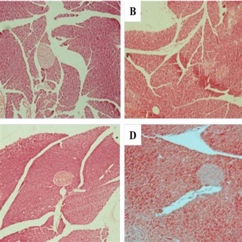 H And E Stained Photomicrographs Of Pancreas Of A Normal Mice B