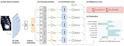 Concept Based Explainable Malignancy Scoring On Pulmonary Nodules In Ct