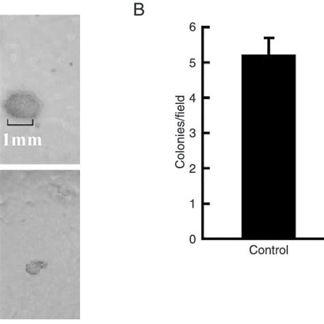 Pituitary Tumor Transforming Gene 1 Pttg1 Knockdown Reduced Pc3 Cell