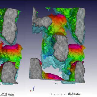 Three Different Angular Views Of The Same Internal Location Showing Download Scientific Diagram