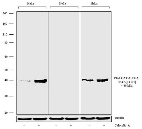 Pka Beta Catalytic Subunitcamp蛋白kinase Catalytic Subunit重组抗体