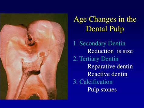 Ppt The Dental Pulp Powerpoint Presentation Id 6725726