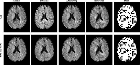 Figure 1 From Diffusion Mri Transformer With A Diffusion Space Rotary