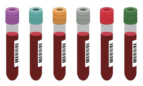 Random Plasma Glucose Test