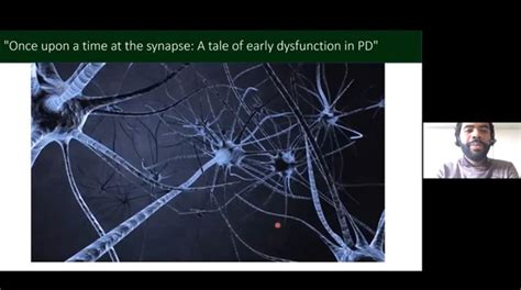Once Upon A Time At The Synapse A Tale Of Early Dysfunction In Pd