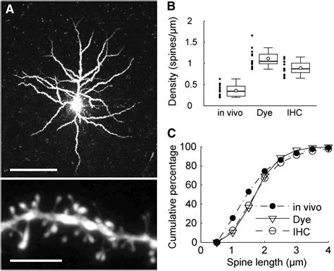 Dendritic Spine