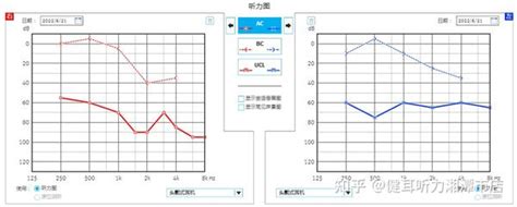 能听清楚了真好啊 知乎