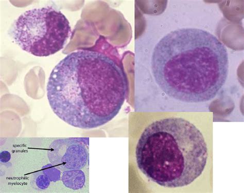 Neutrophilic Myelocytes