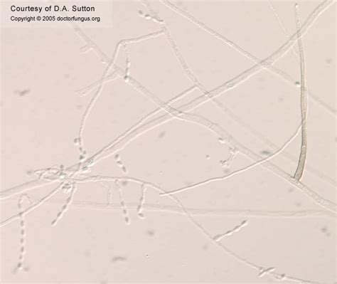 Acrophialophora Fusispora Doctor Fungus