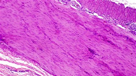 Section Of Human Duodenum Filmed Under Microscope With 100x