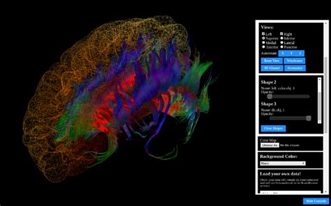 brainbrowser neurological data visualization using html5 and webgl