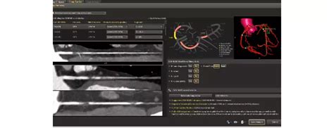 Advanced Visualization Workspace 15 Philips
