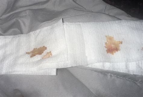 Breast Lift And Augmentation 3 Days Ago Is Still Bleeding Out Of