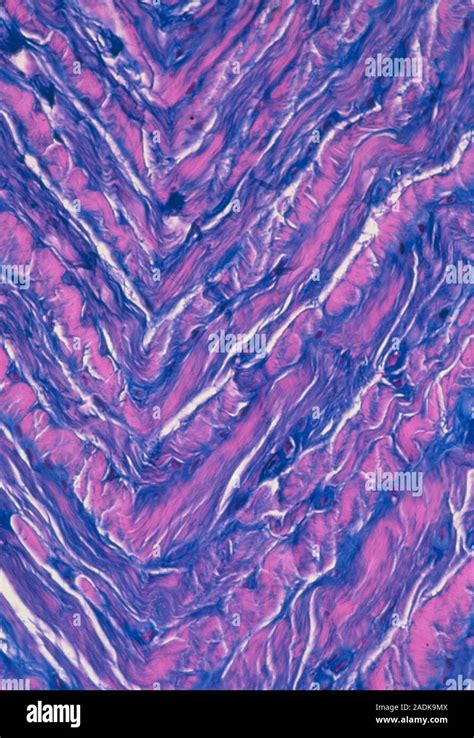 Fibrocartilage Histology 1500x1225