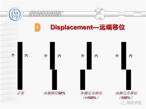 40张ppt带你读懂骨科x线阅片技巧 德医医学 助力医学教育发展！