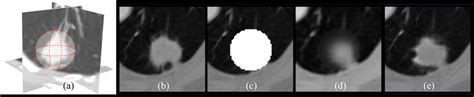 Lung Nodule Simulation Using The 3d Cgan A A Voi Centered At A Lung