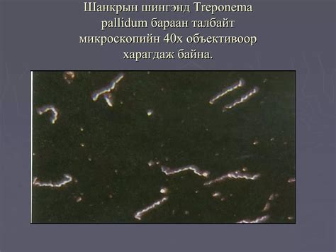 Gram Staining Altanzul Ppt