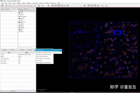 使用QuPath Cellpose StarDist分析蛋白入核比率 知乎