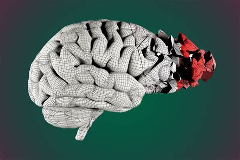 Drogas Psiquiátricas “ajudam” Ao Causar Uma Disfunção Cerebral Mad
