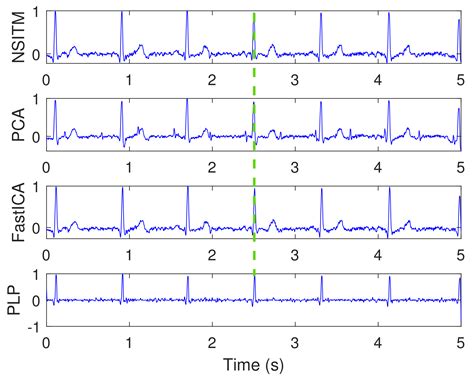 Sensors Free Full Text A Null Space Based Blind Source Separation