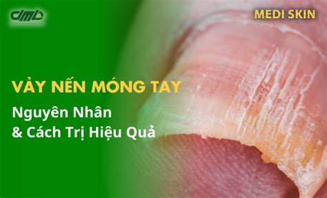 Chuyên Mục Da Liễu Dược D Medic