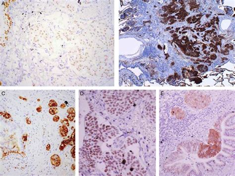 At Immunohistochemistry Peripheral Neuroendocrine Cell Proliferation