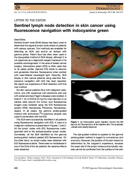 Pdf Sentinel Lymph Node Detection In Skin Cancer Using Fluorescence Navigation With