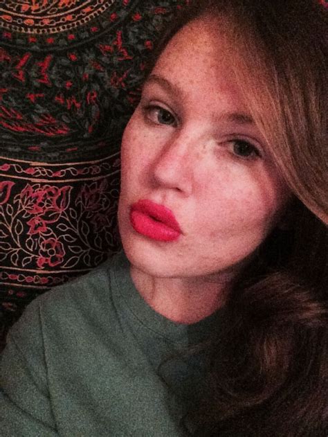 Freckles Redheads Freckles Freckles Redheads