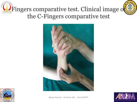 Forearm Instability Ppt