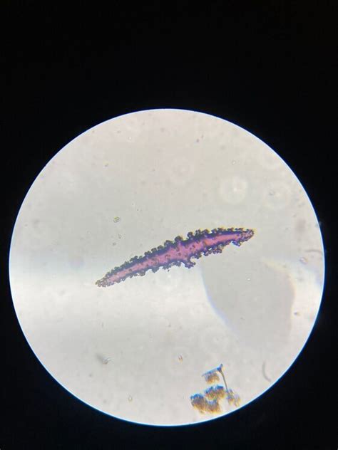 Microscope Discovery Identification Forum Nano Reef Community