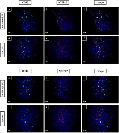 Immunofluorescence Double Staining With Anti Actbl2 Anti Cd45 And