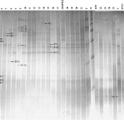 Tgge Band Profiles Of V3 Fragments Of 16s Rdna Gene Amplified With