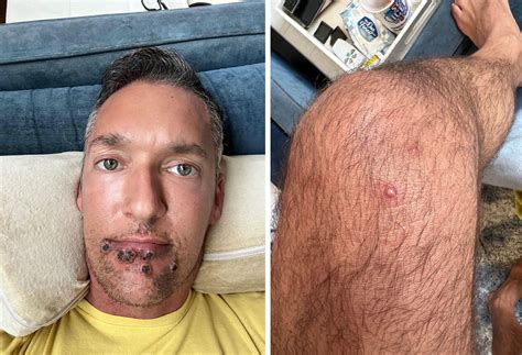 Hur Får Man Apkoppor Remedied Utility