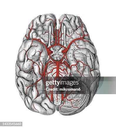 Circle Of Willis Unlabeled