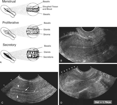 Ultrasound Evaluation Of The Uterus Clinical Tree