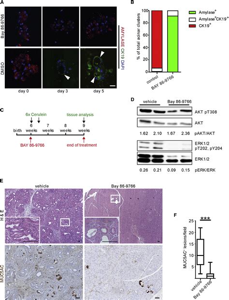 Egf Receptor Is Required For Kras Induced Pancreatic Tumorigenesis