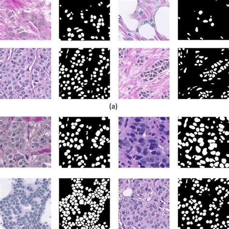 Visualization Of Segmentation Performance On Tnbc Dataset The First