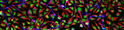 Biomaterials For Neural Regeneration Institute For Bioengineering Of
